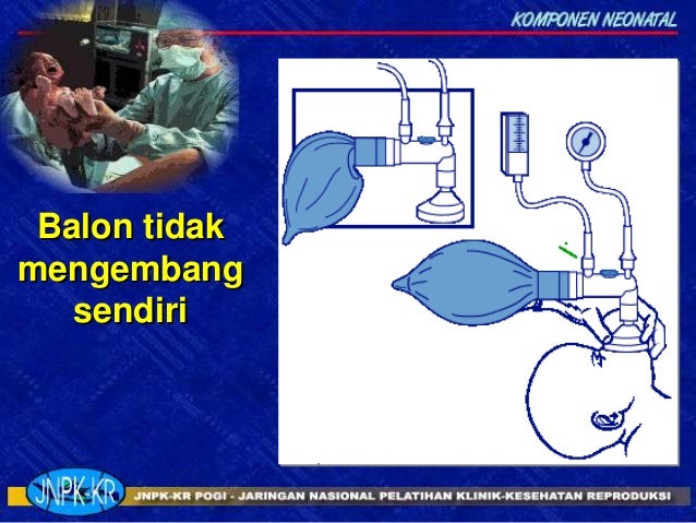 Resusitasi pada Bayi