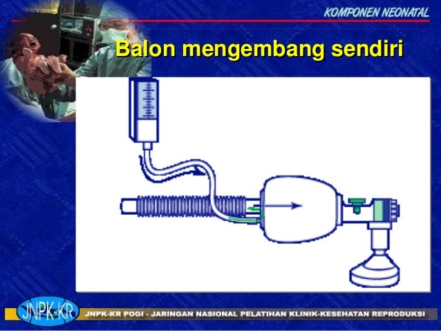 Resusitasi pada Bayi