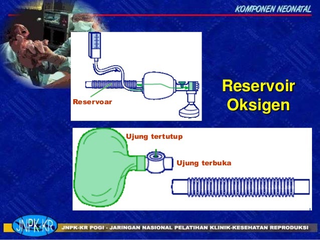 Resusitasi pada Bayi