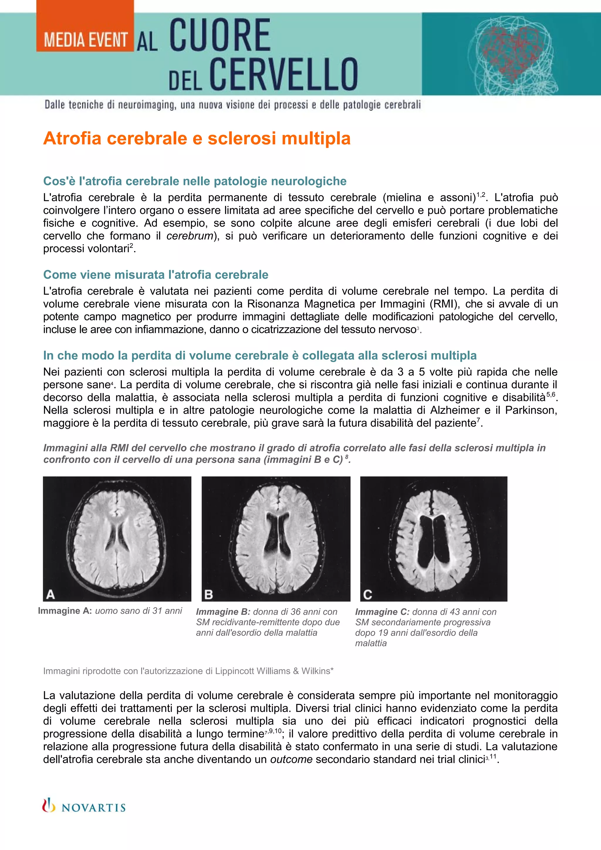 07 scheda atrofia_cerebrale | DOC