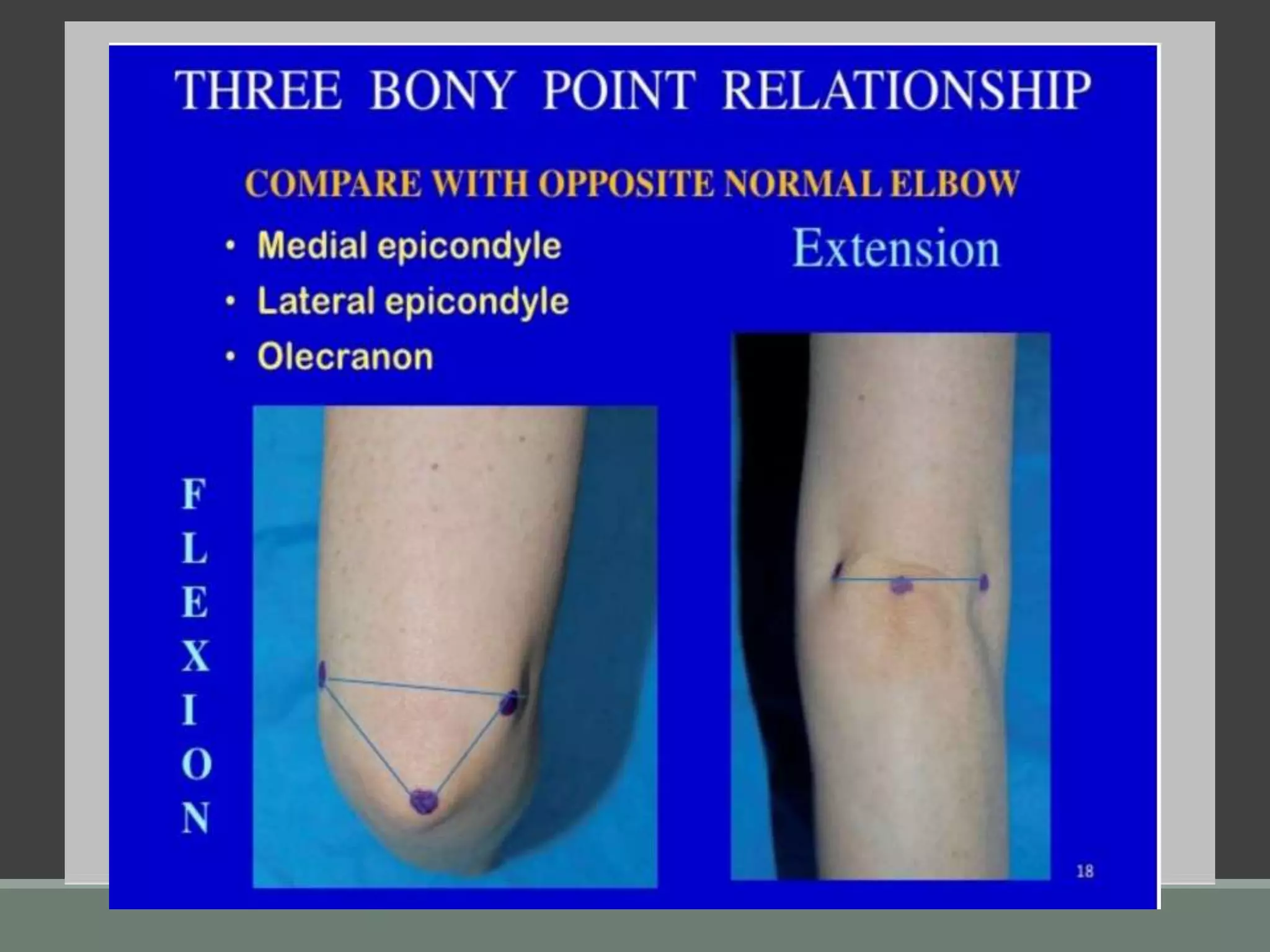 paediatric injuries around the elbow. | PPTX