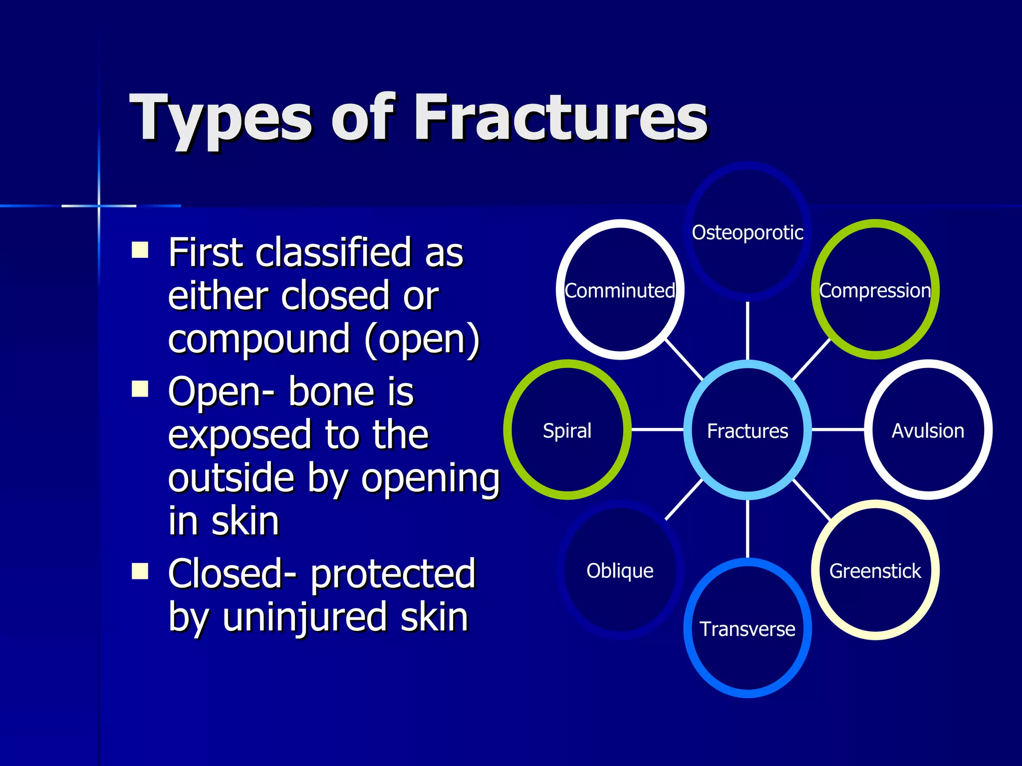07 Fractures | PPT
