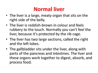 6. The Liver Notes | PPT