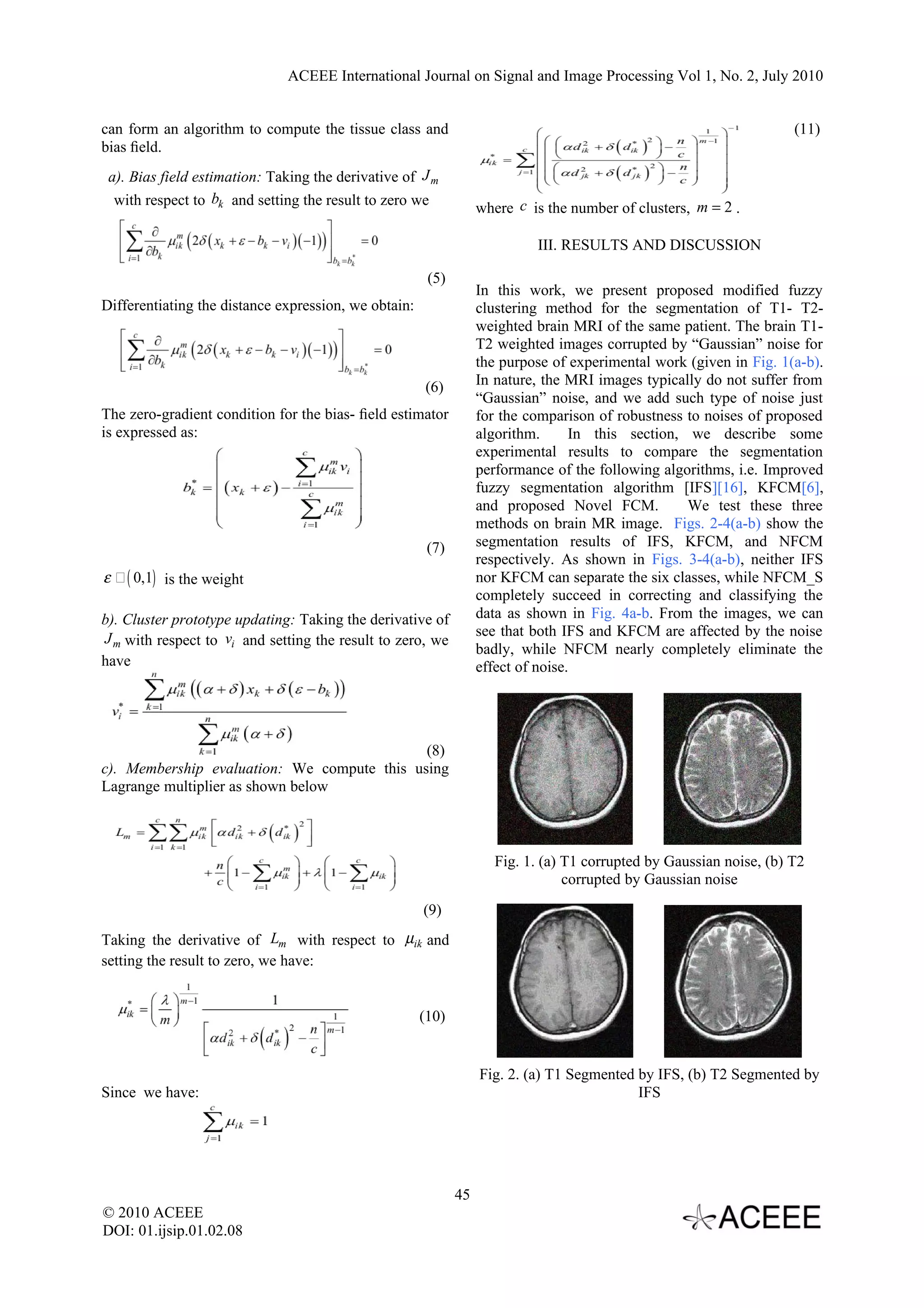 Fuzzy clustering Approach in segmentation of T1-T2 brain MRI | PDF