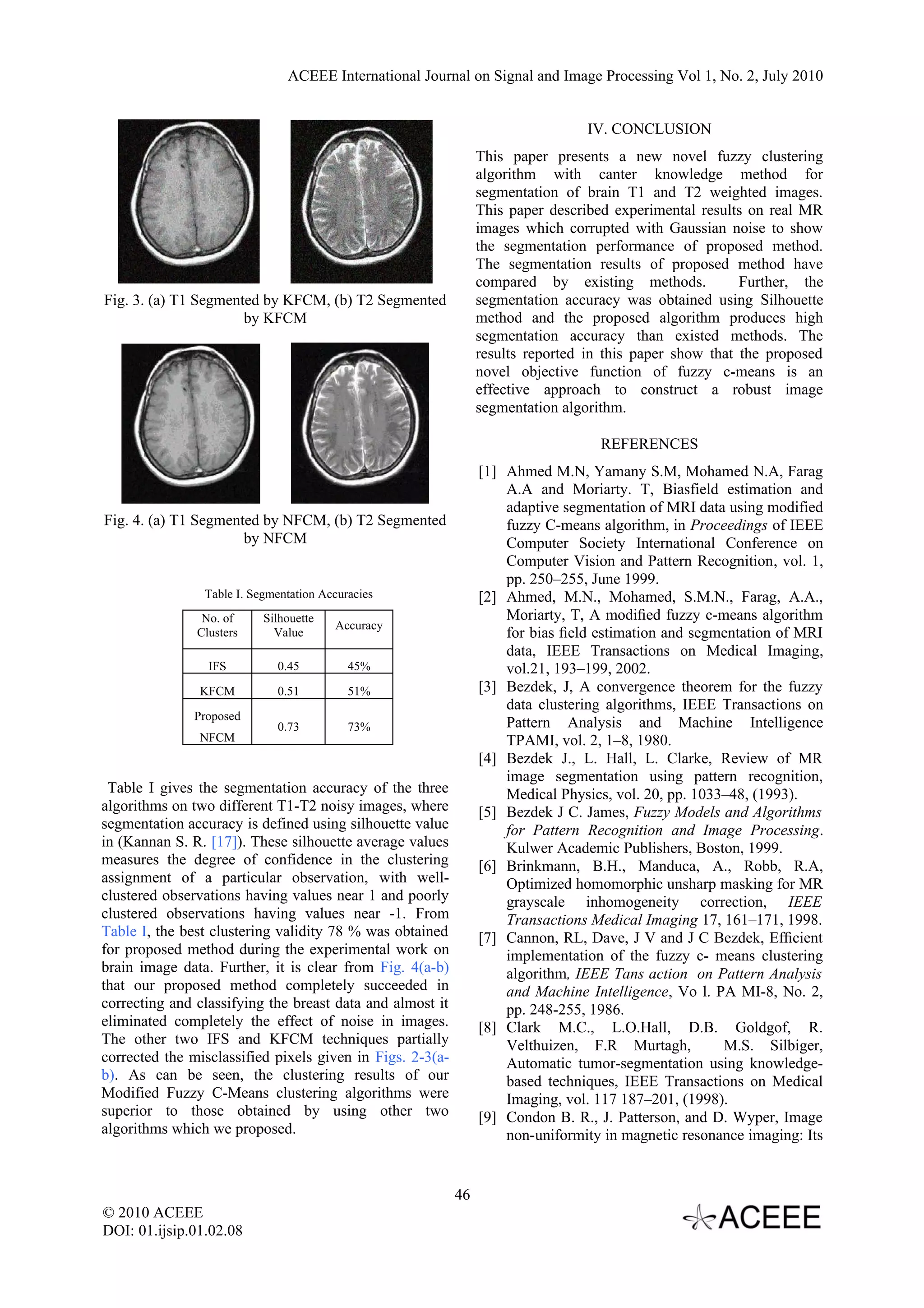 Fuzzy clustering Approach in segmentation of T1-T2 brain MRI | PDF