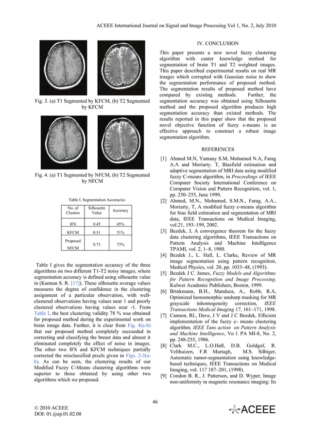 Fuzzy clustering Approach in segmentation of T1-T2 brain MRI | PDF