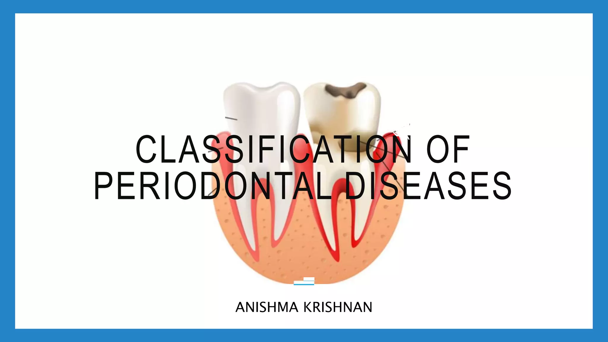 classification of periodontal diseases | PPTX