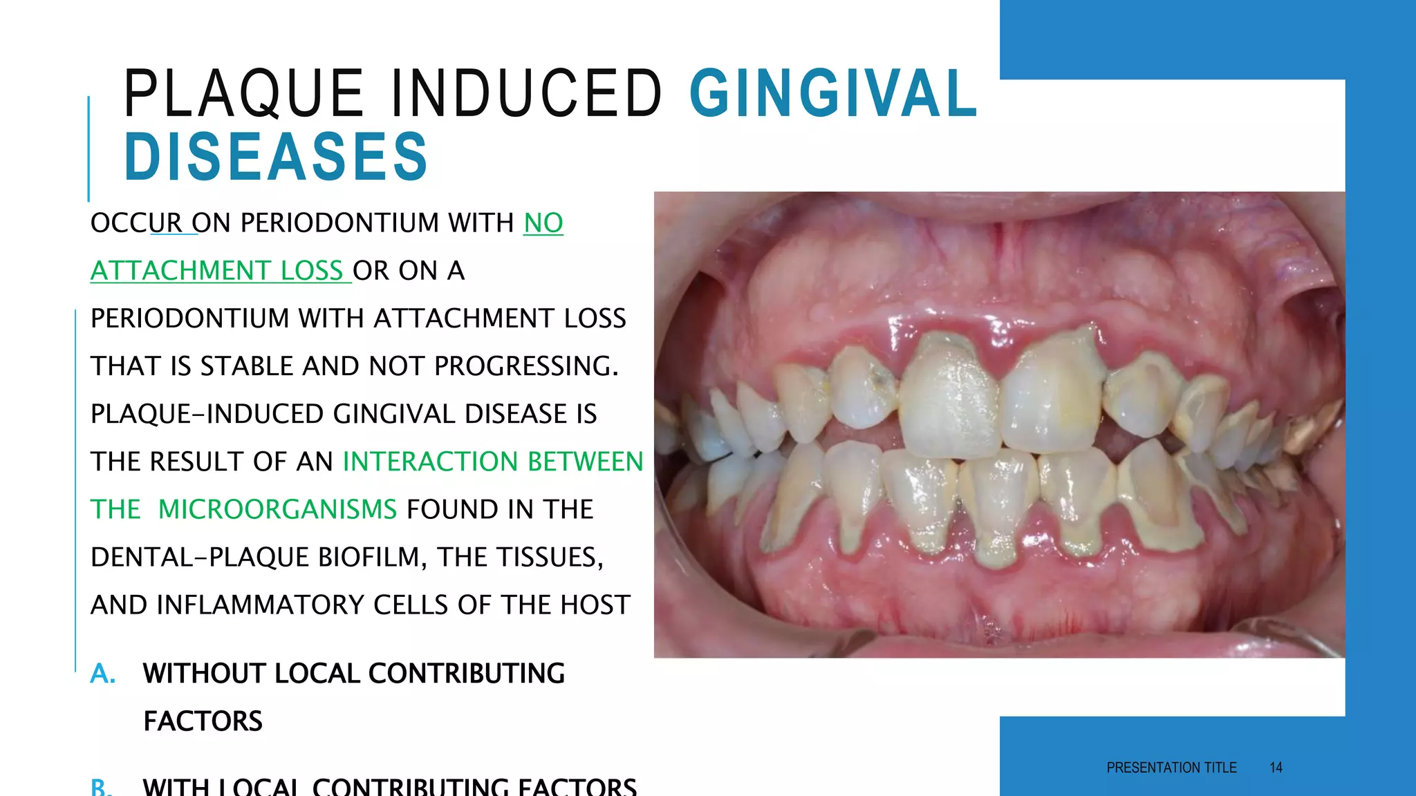 classification of periodontal diseases | PPTX