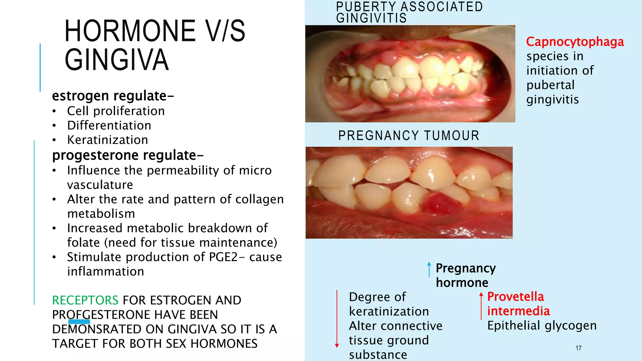classification of periodontal diseases | PPTX