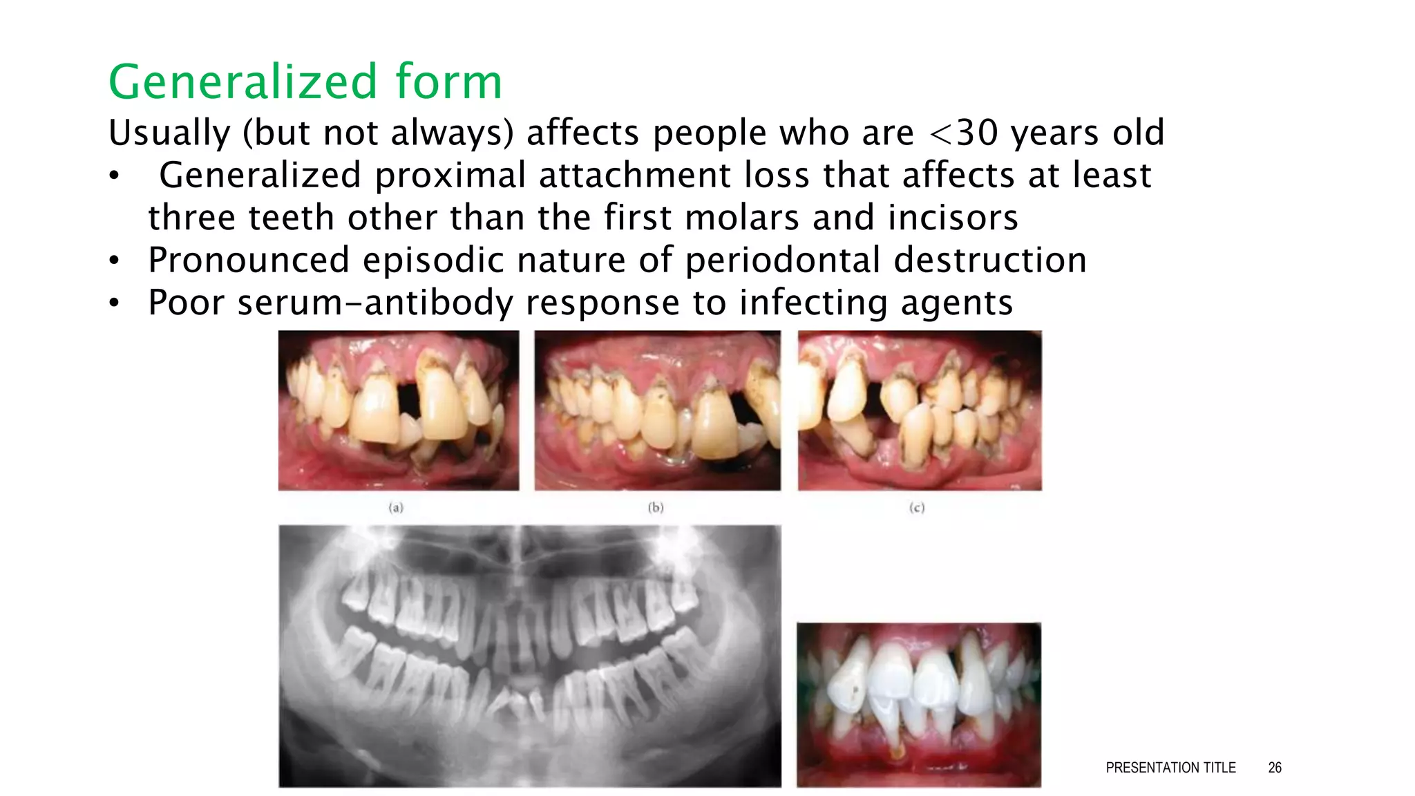 classification of periodontal diseases | PPTX