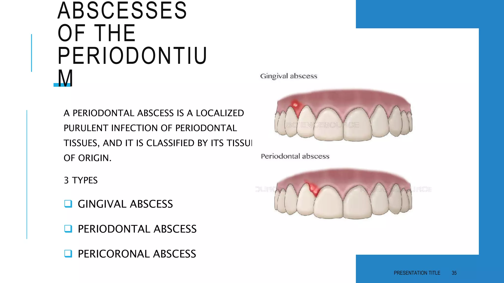 classification of periodontal diseases | PPTX