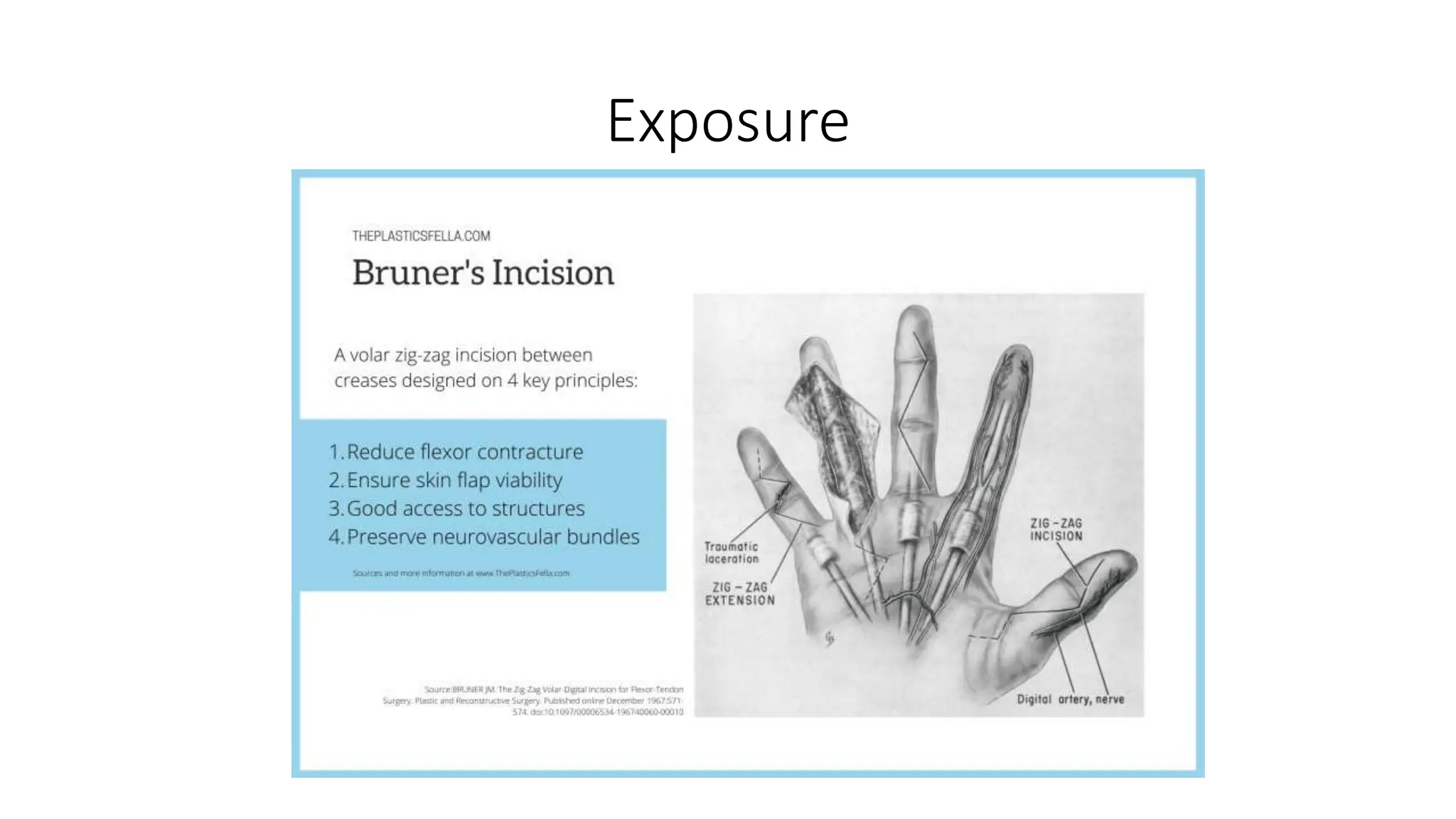 Hand flexor tendon repair basics 40 characters | PPT