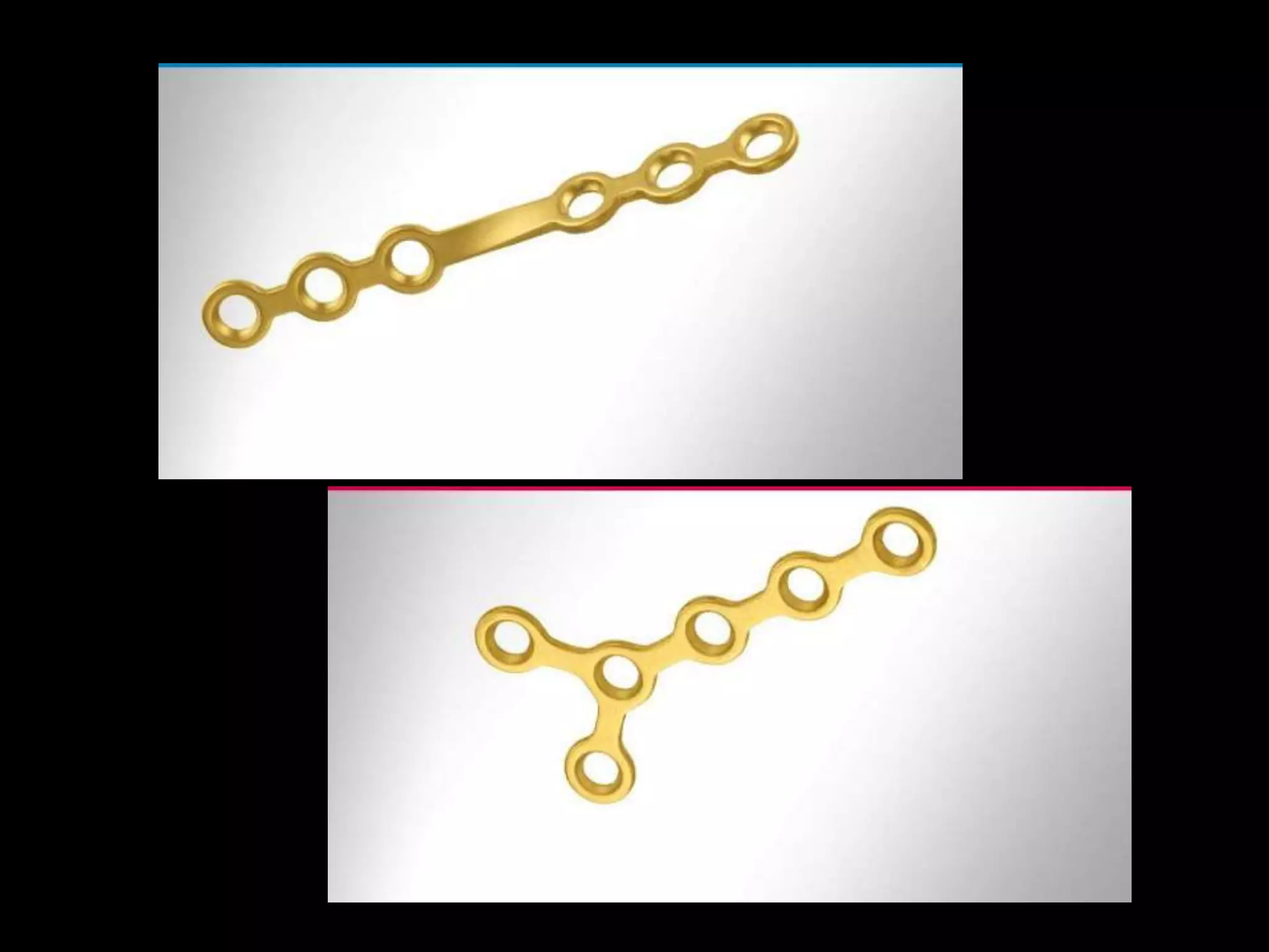 osteosynthesis materials and systems | PPTX