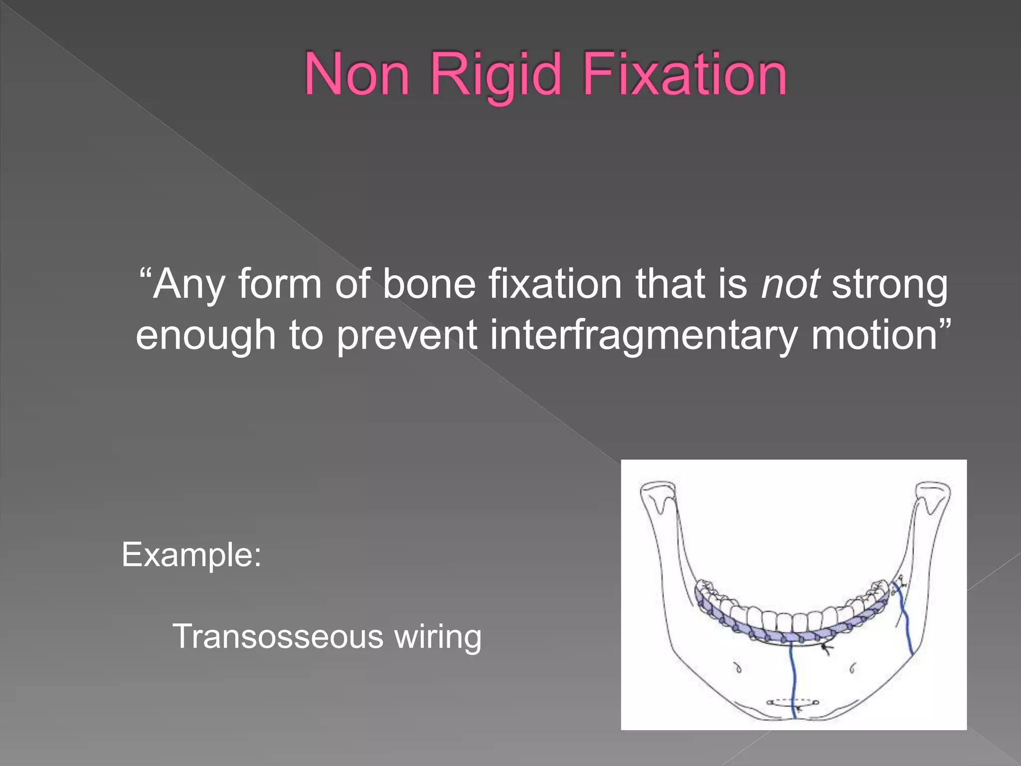 osteosynthesis materials and systems | PPTX