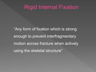 osteosynthesis materials and systems | PPTX