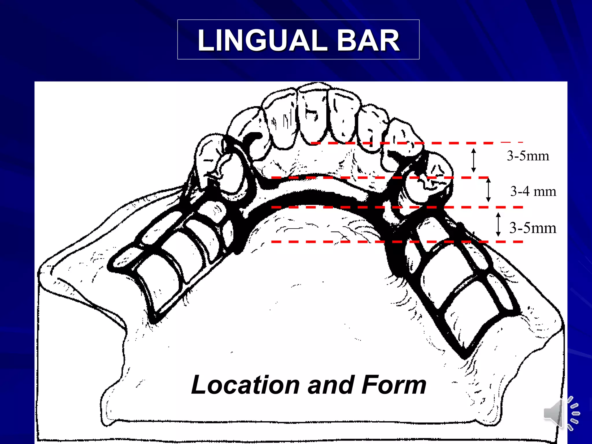 Mandibular major connectors and minor connectors | PPT
