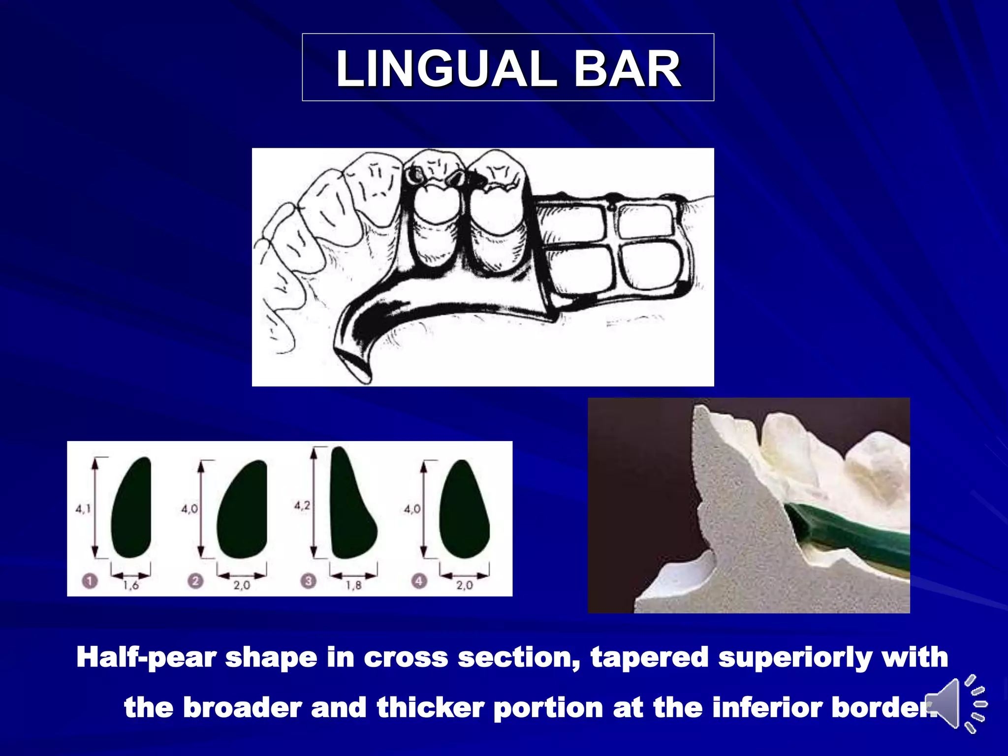 Mandibular major connectors and minor connectors | PPT