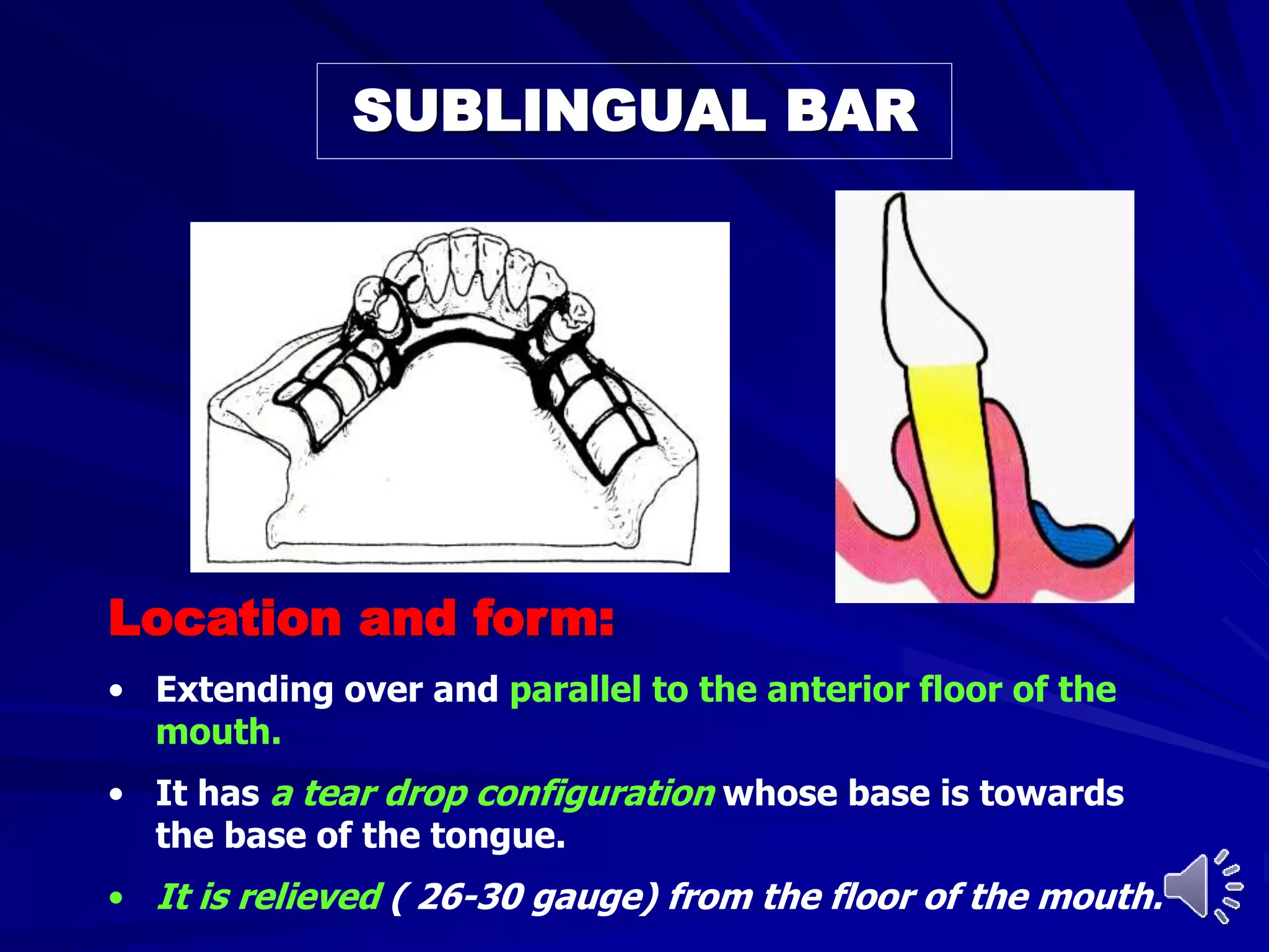 Mandibular major connectors and minor connectors | PPT