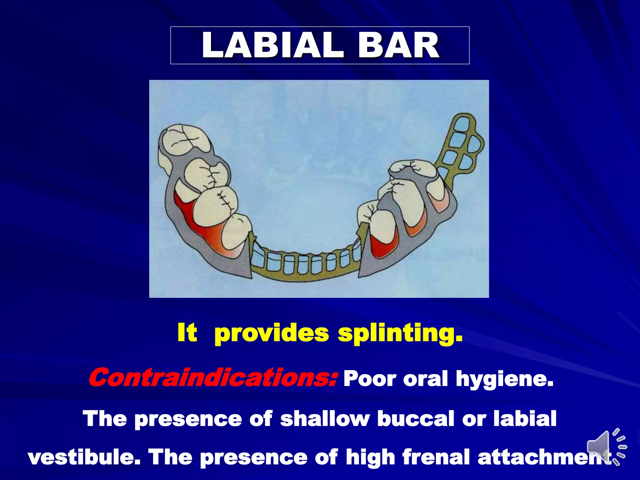 Mandibular major connectors and minor connectors | PPT
