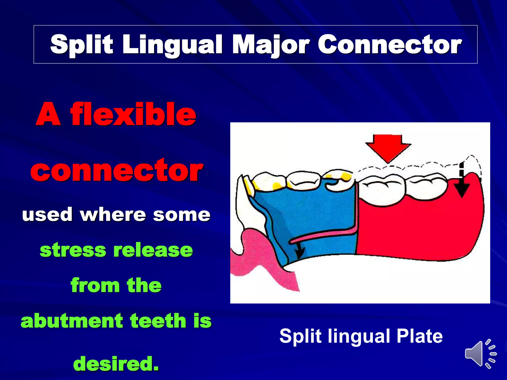 Mandibular major connectors and minor connectors | PPT