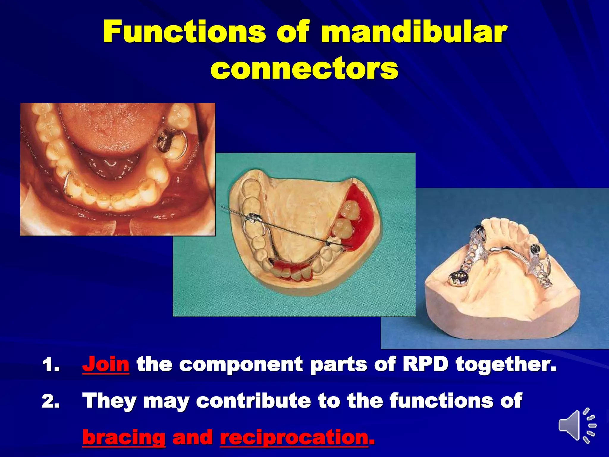 Mandibular major connectors and minor connectors | PPT