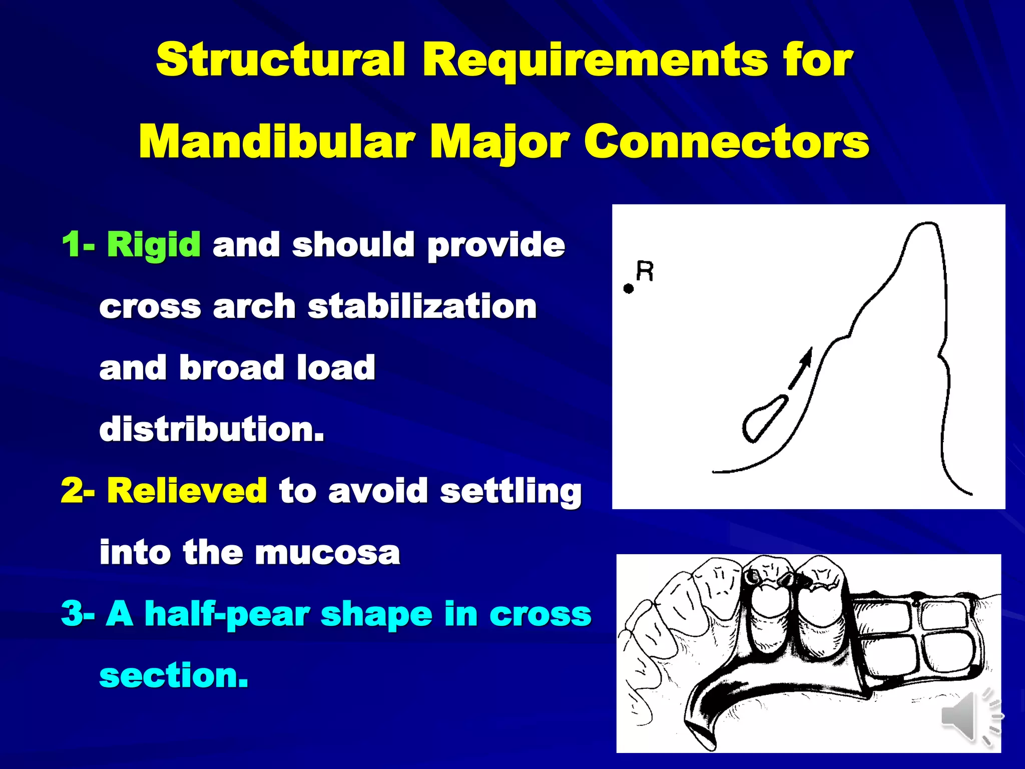 Mandibular major connectors and minor connectors | PPT