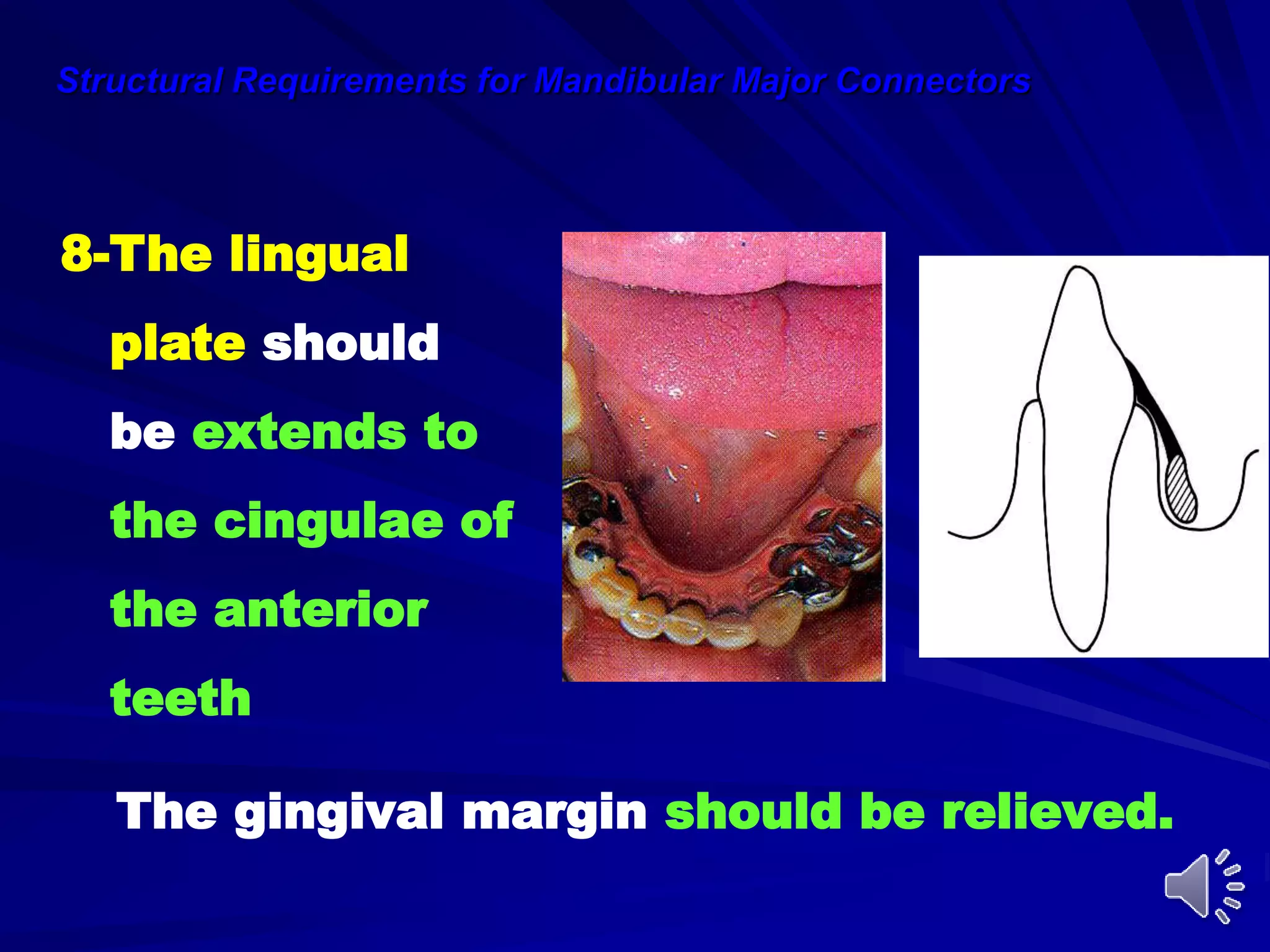 Mandibular major connectors and minor connectors | PPT