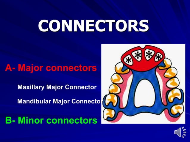 Mandibular major connectors and minor connectors | PPT | Oral care ...
