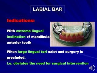 Mandibular major connectors and minor connectors | PPT
