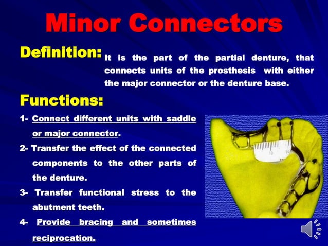 Mandibular major connectors and minor connectors | PPT | Oral care ...