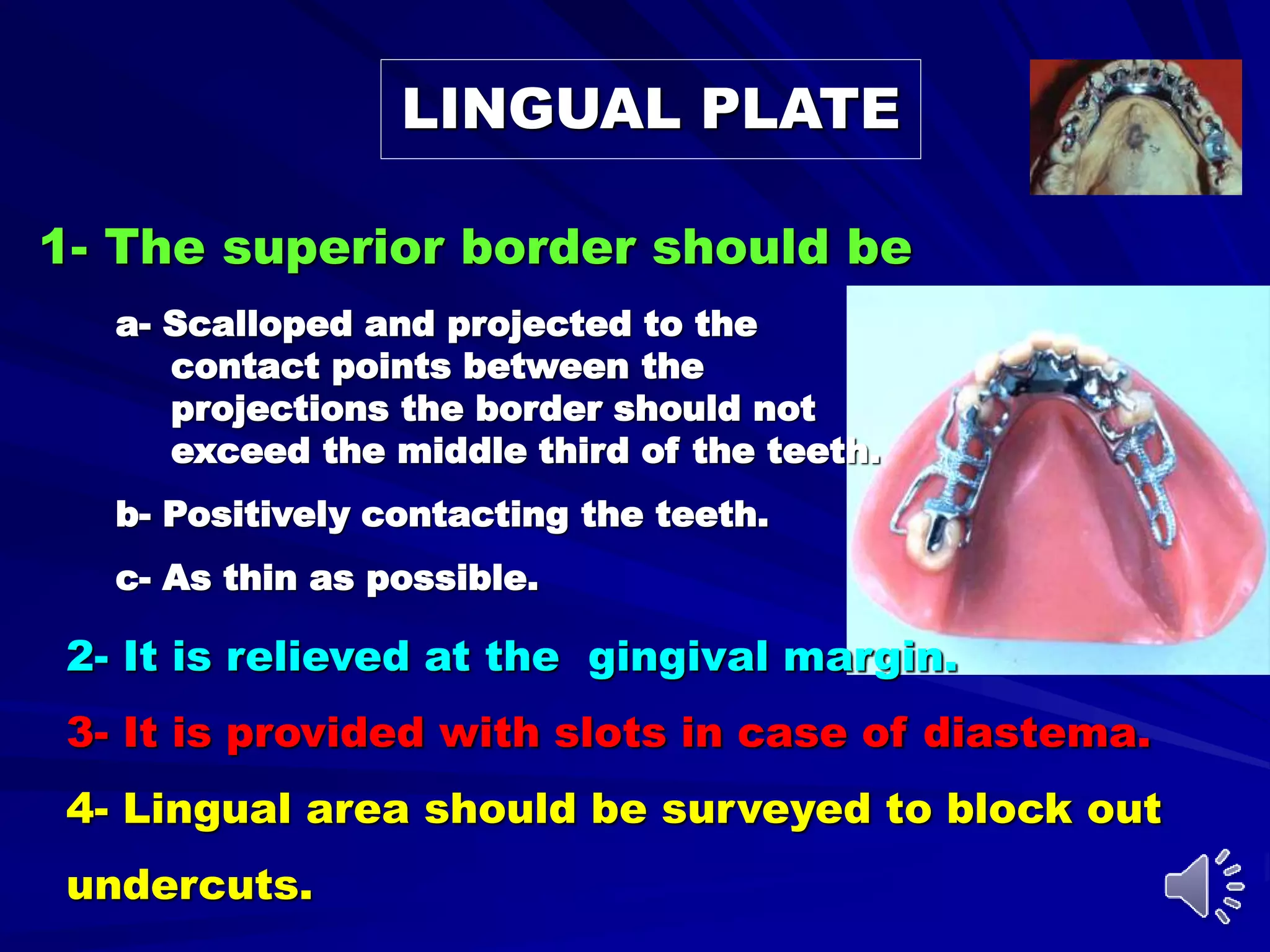Mandibular major and minor connectors of RPDs | PPT