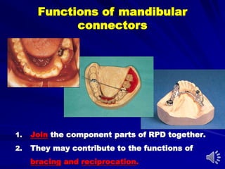 Mandibular major and minor connectors of RPDs | PPT