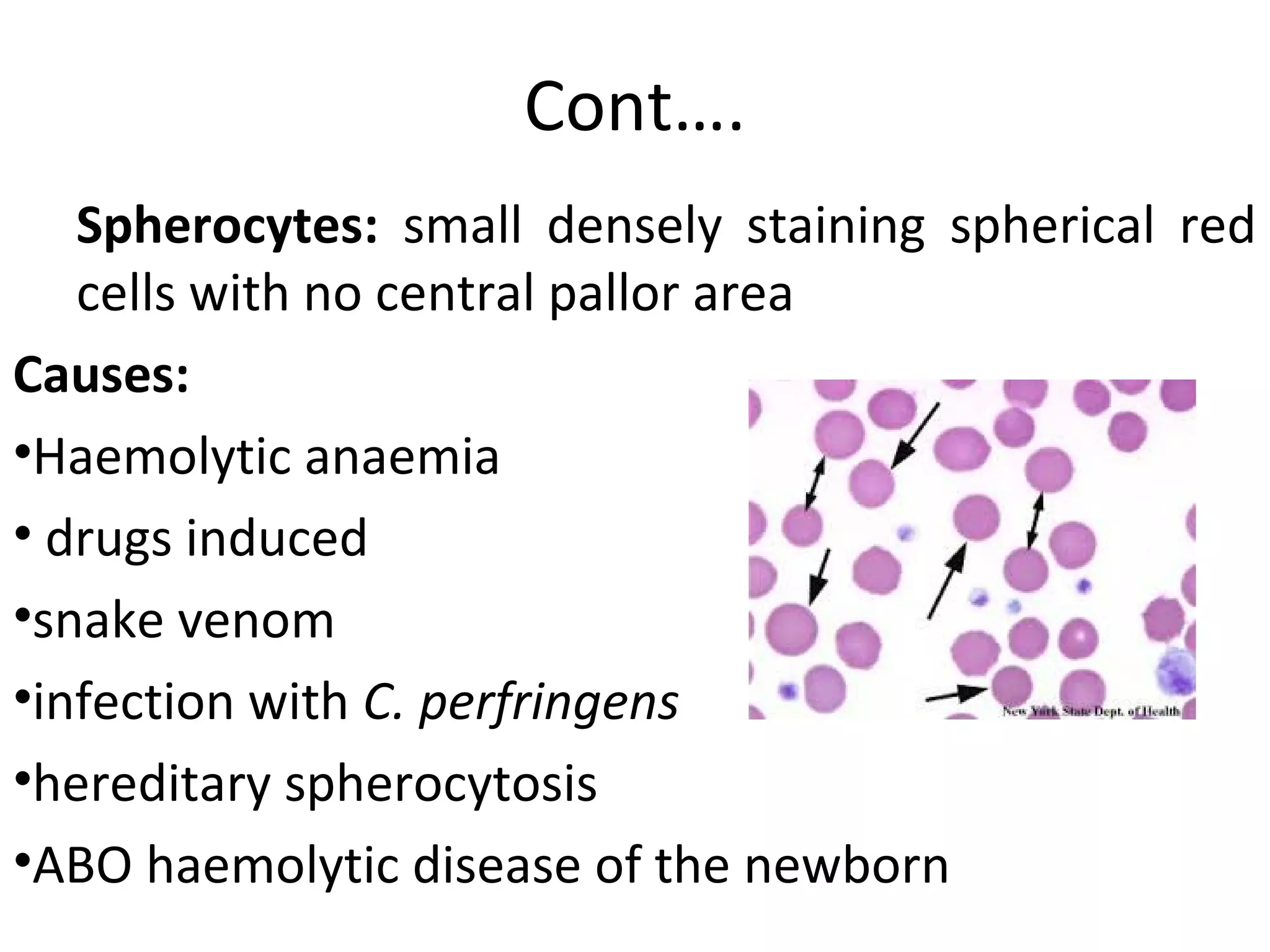 morphology of red blood cells | PPT