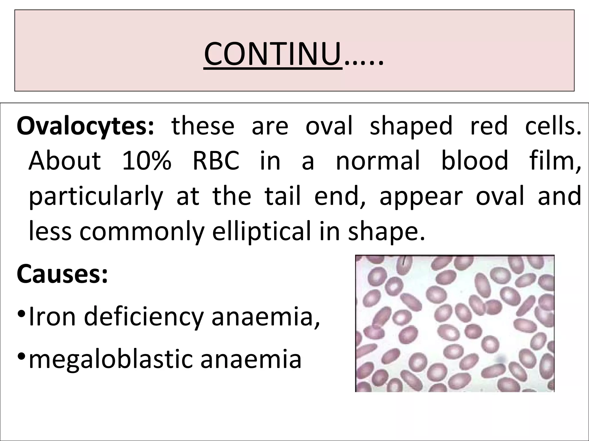 morphology of red blood cells | PPT