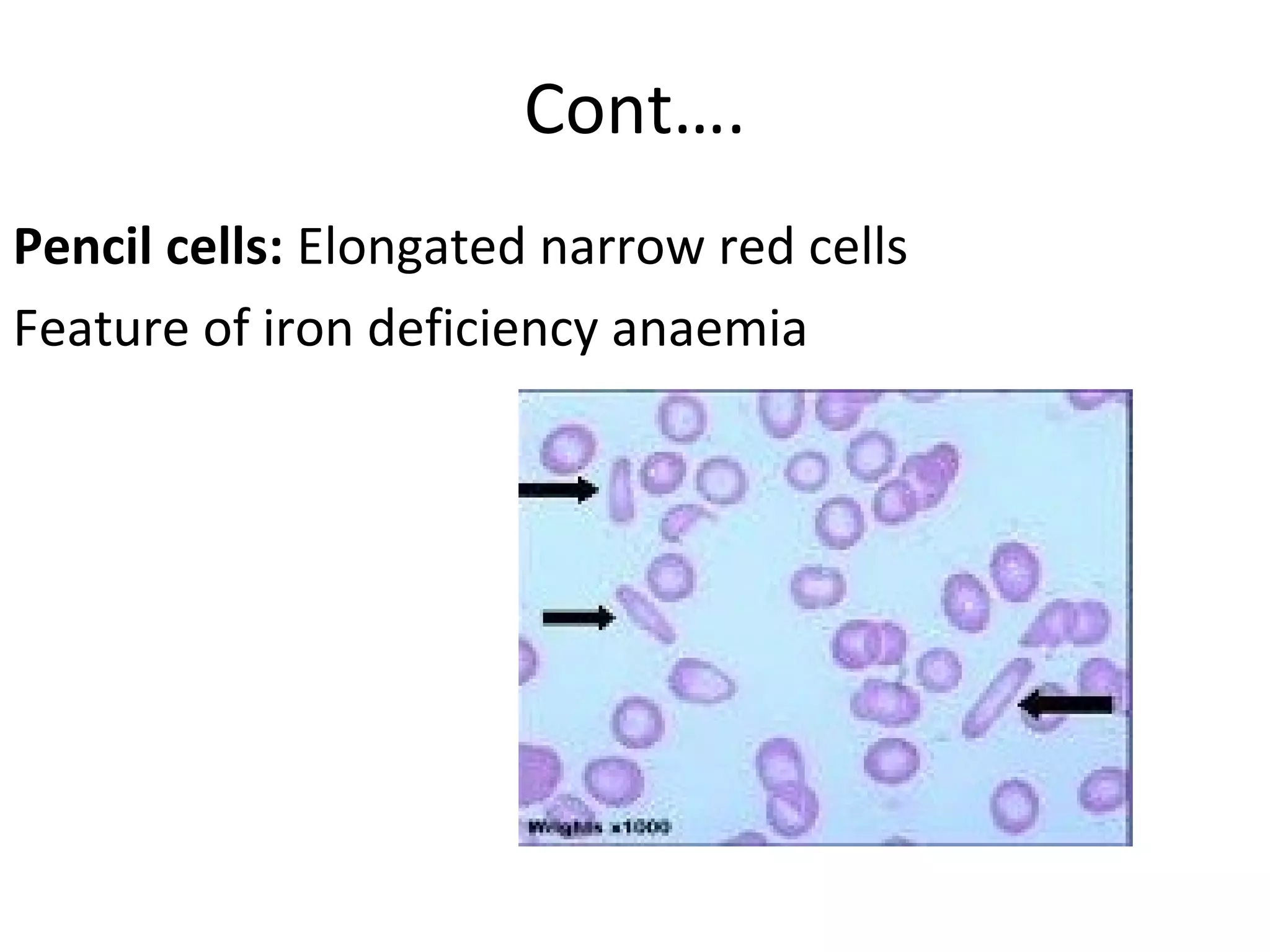 morphology of red blood cells | PPT | Blood Disorders | Diseases and ...