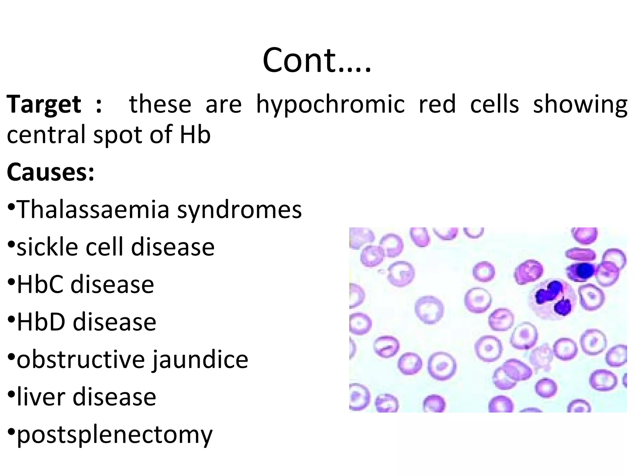 morphology of red blood cells | PPT