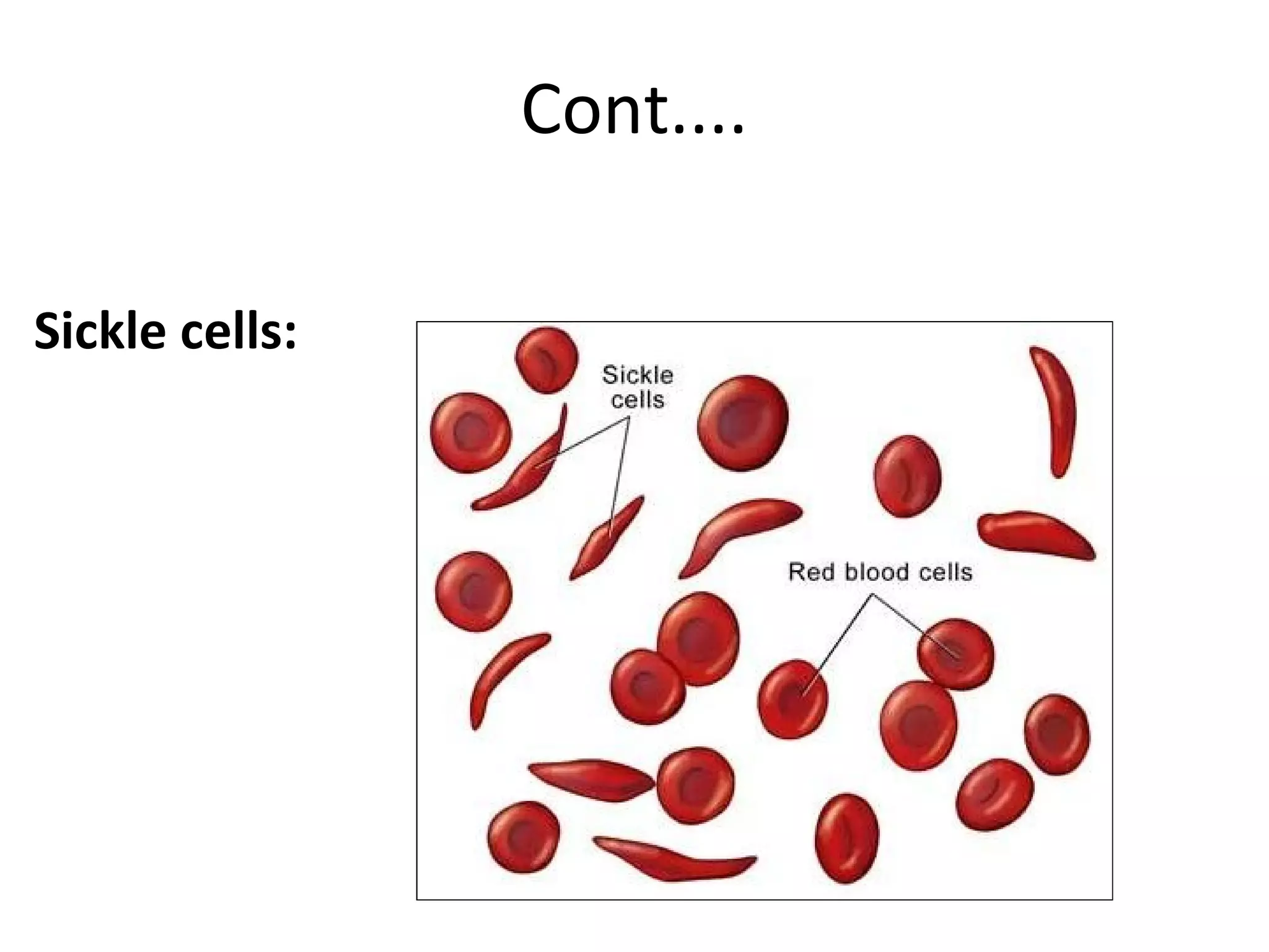 morphology of red blood cells | PPT