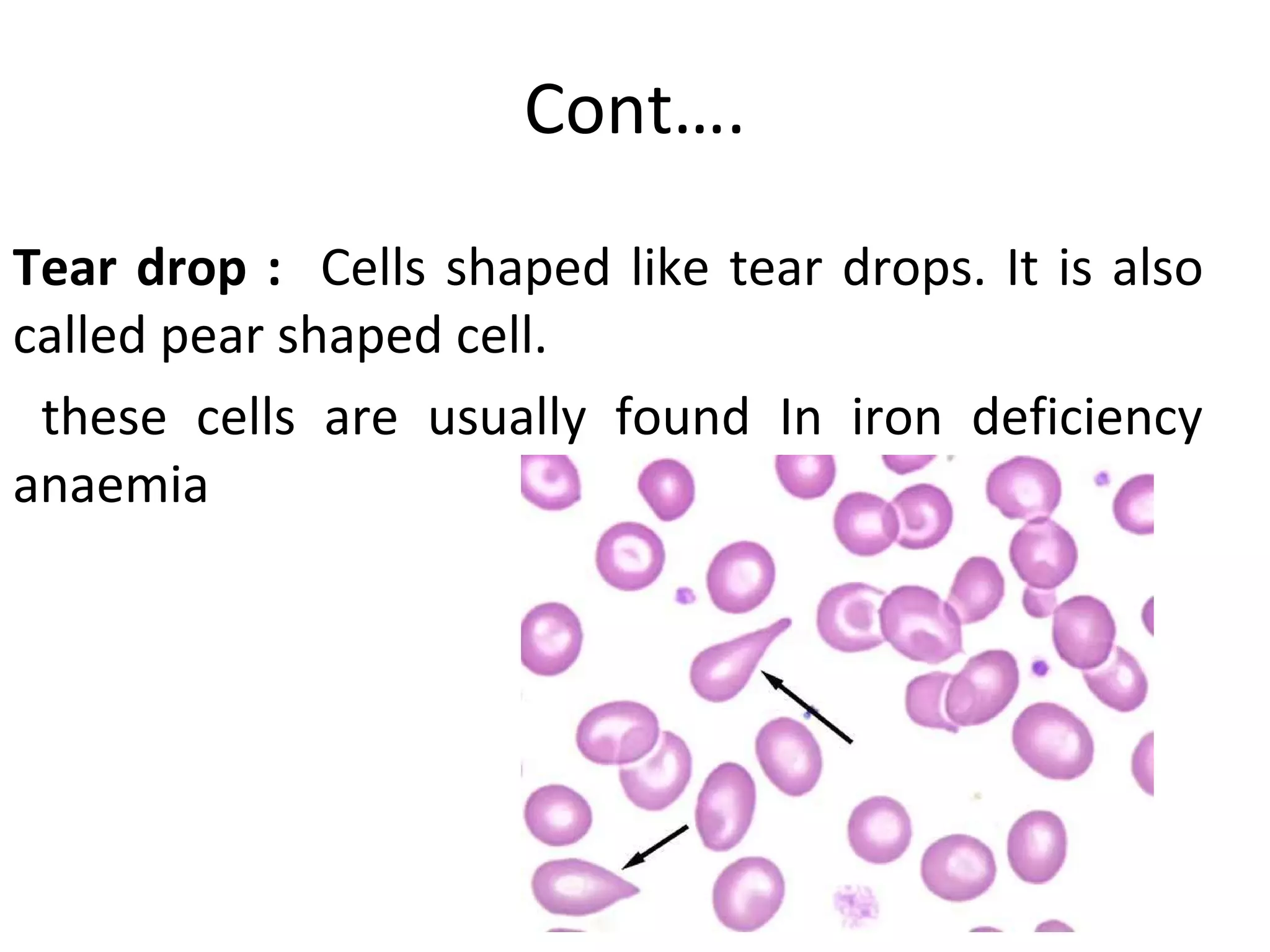 morphology of red blood cells | PPT