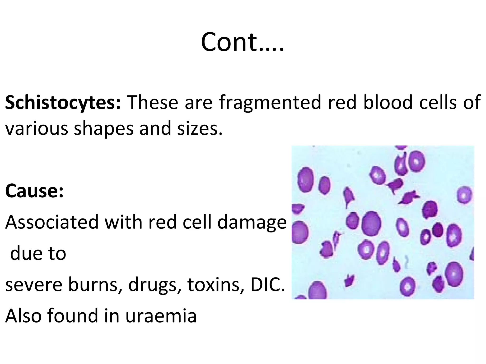 morphology of red blood cells | PPT | Blood Disorders | Diseases and ...
