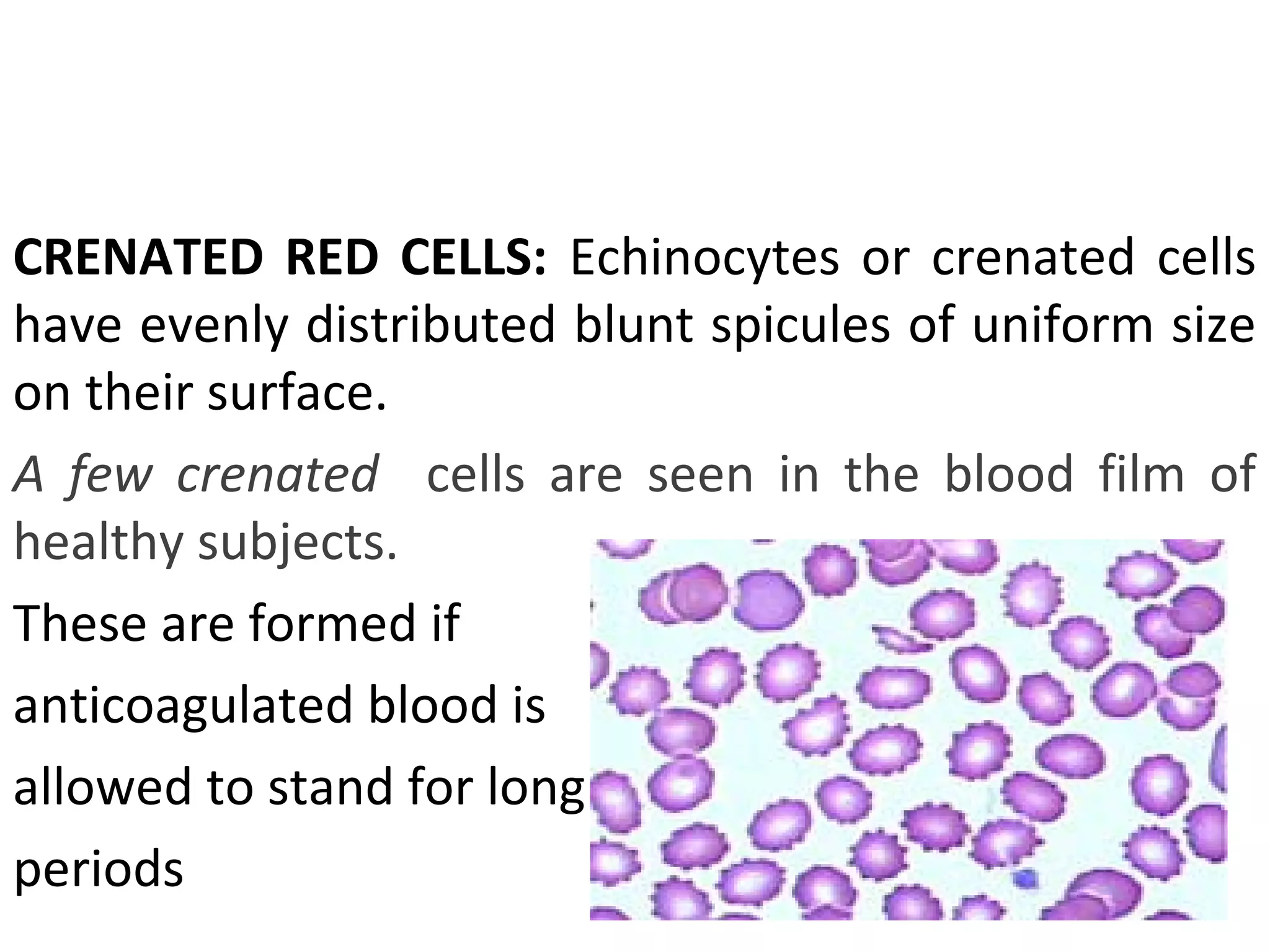 morphology of red blood cells | PPT
