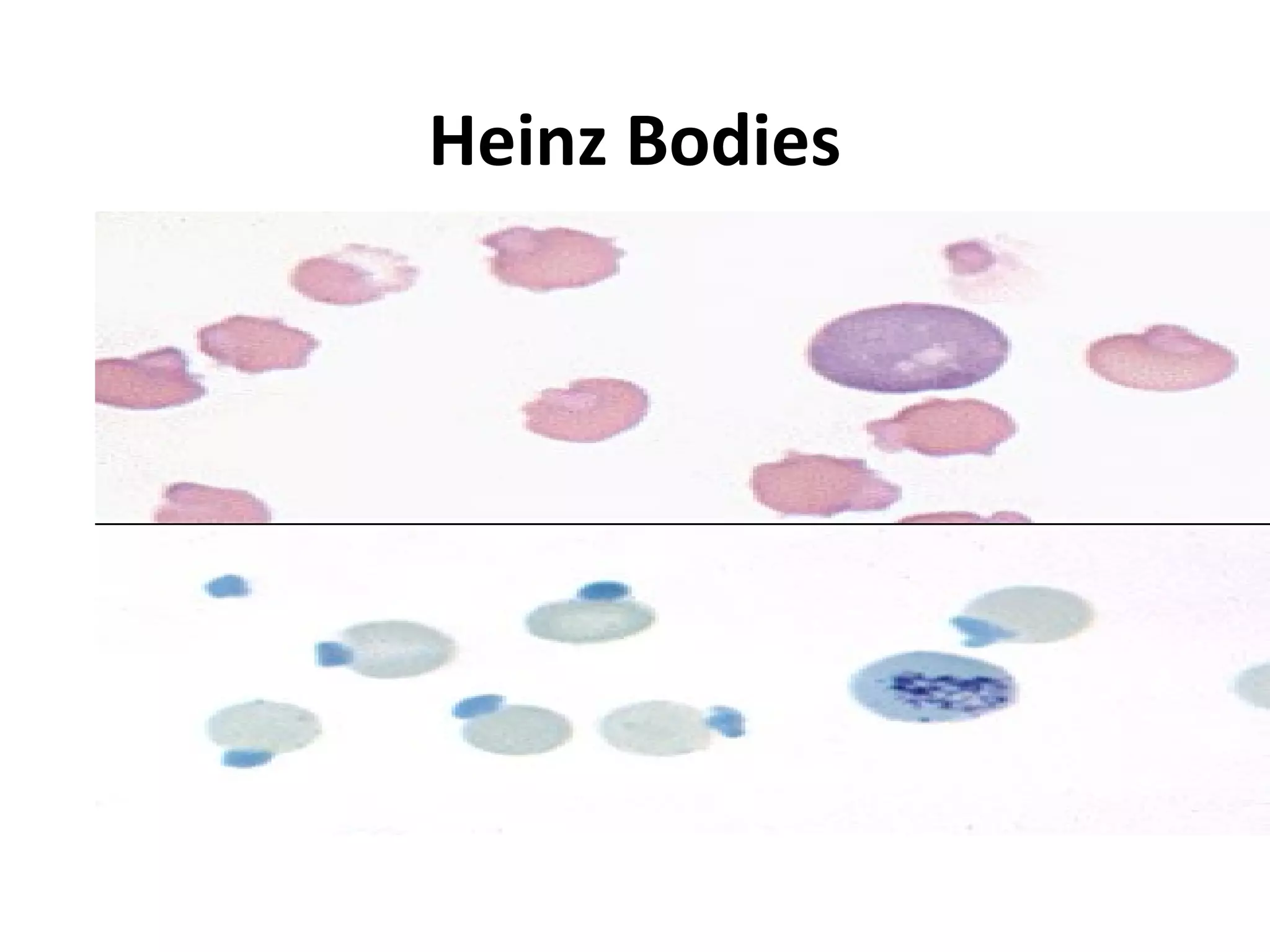 morphology of red blood cells | PPT