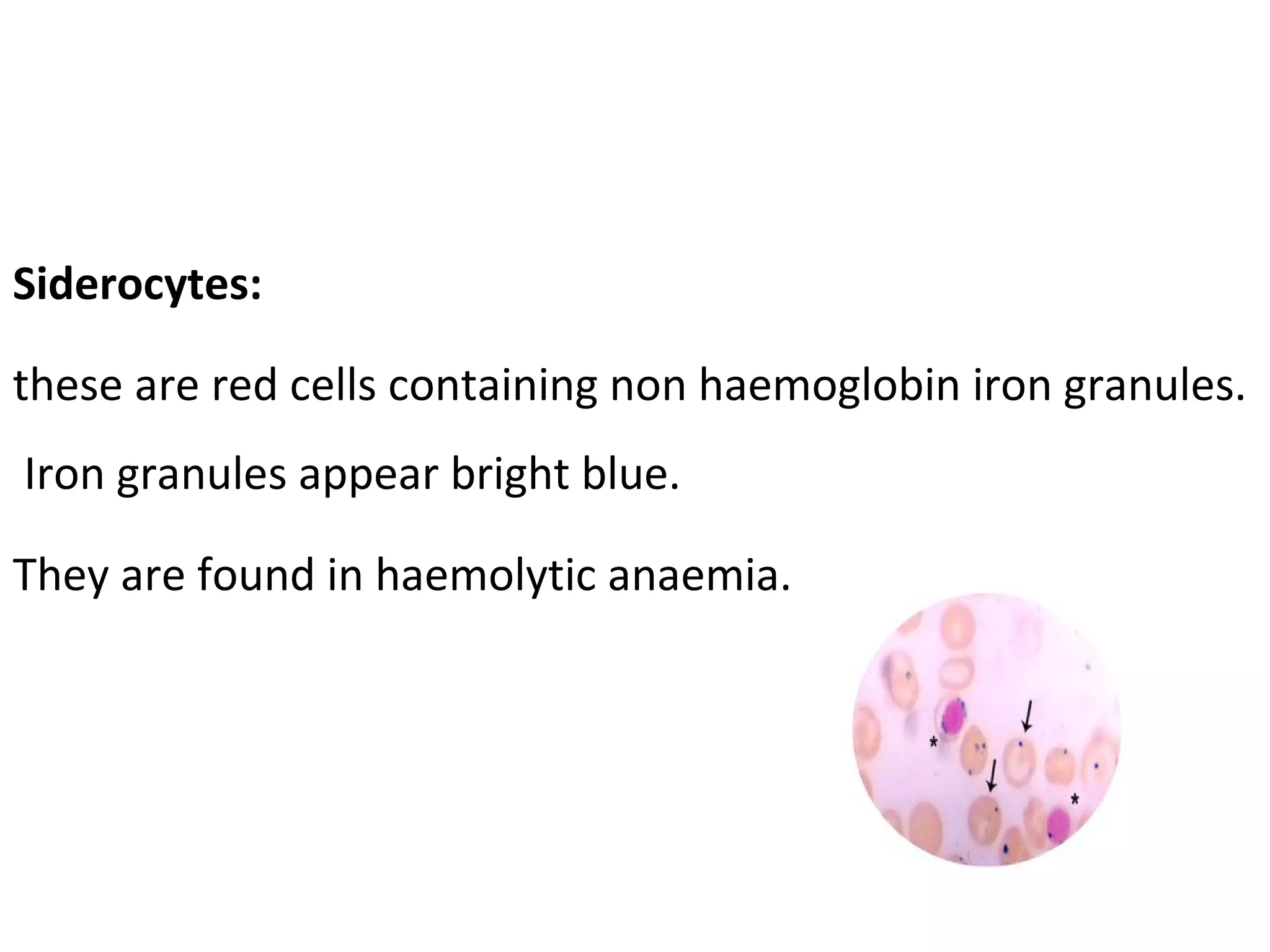 morphology of red blood cells | PPT | Blood Disorders | Diseases and ...