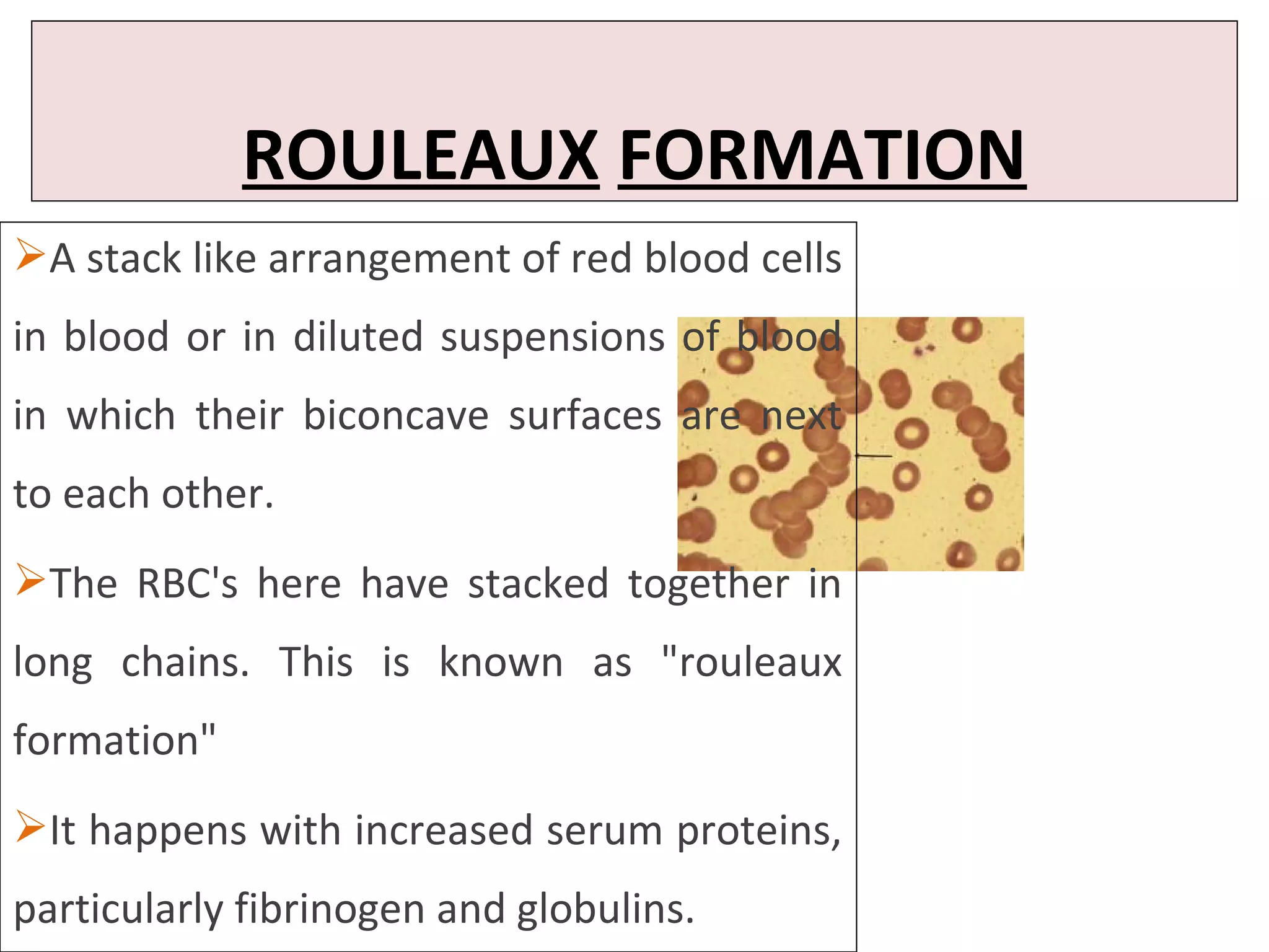 morphology of red blood cells | PPT