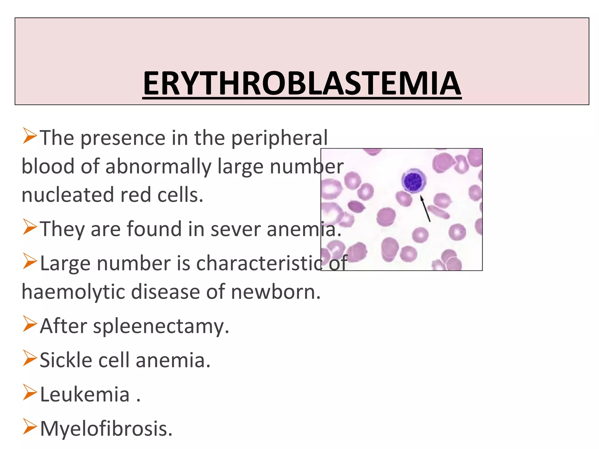 morphology of red blood cells | PPT