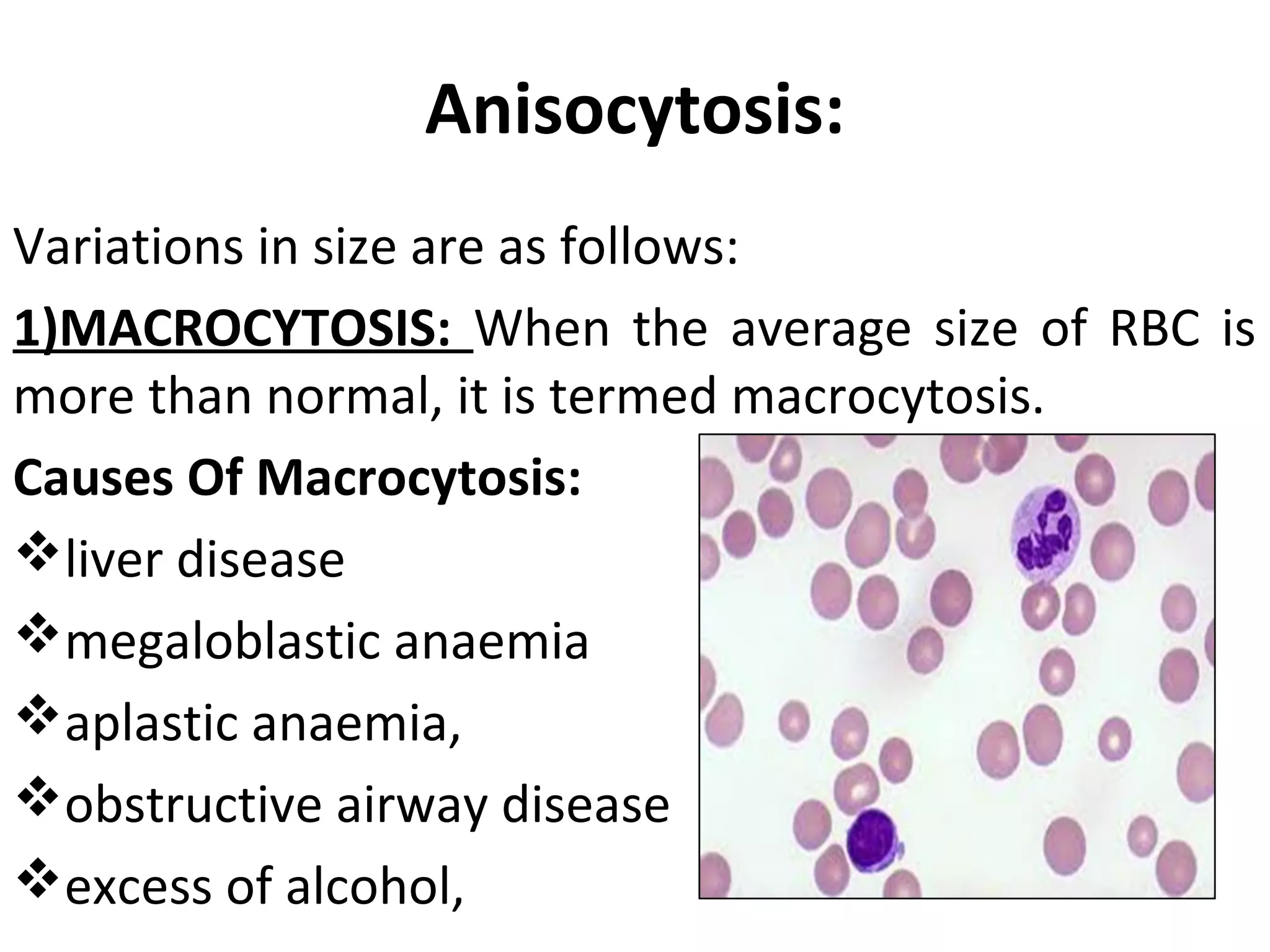 morphology of red blood cells | PPT