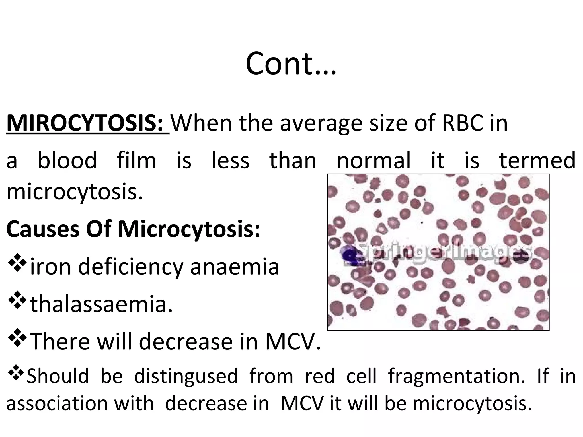 morphology of red blood cells | PPT