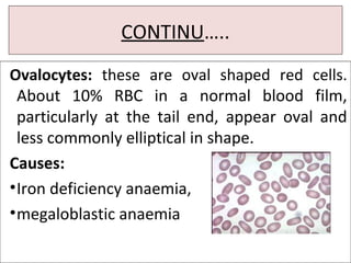 morphology of red blood cells | PPT