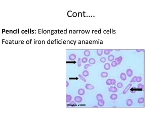 morphology of red blood cells | PPT