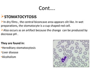morphology of red blood cells | PPT