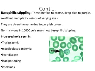 morphology of red blood cells | PPT